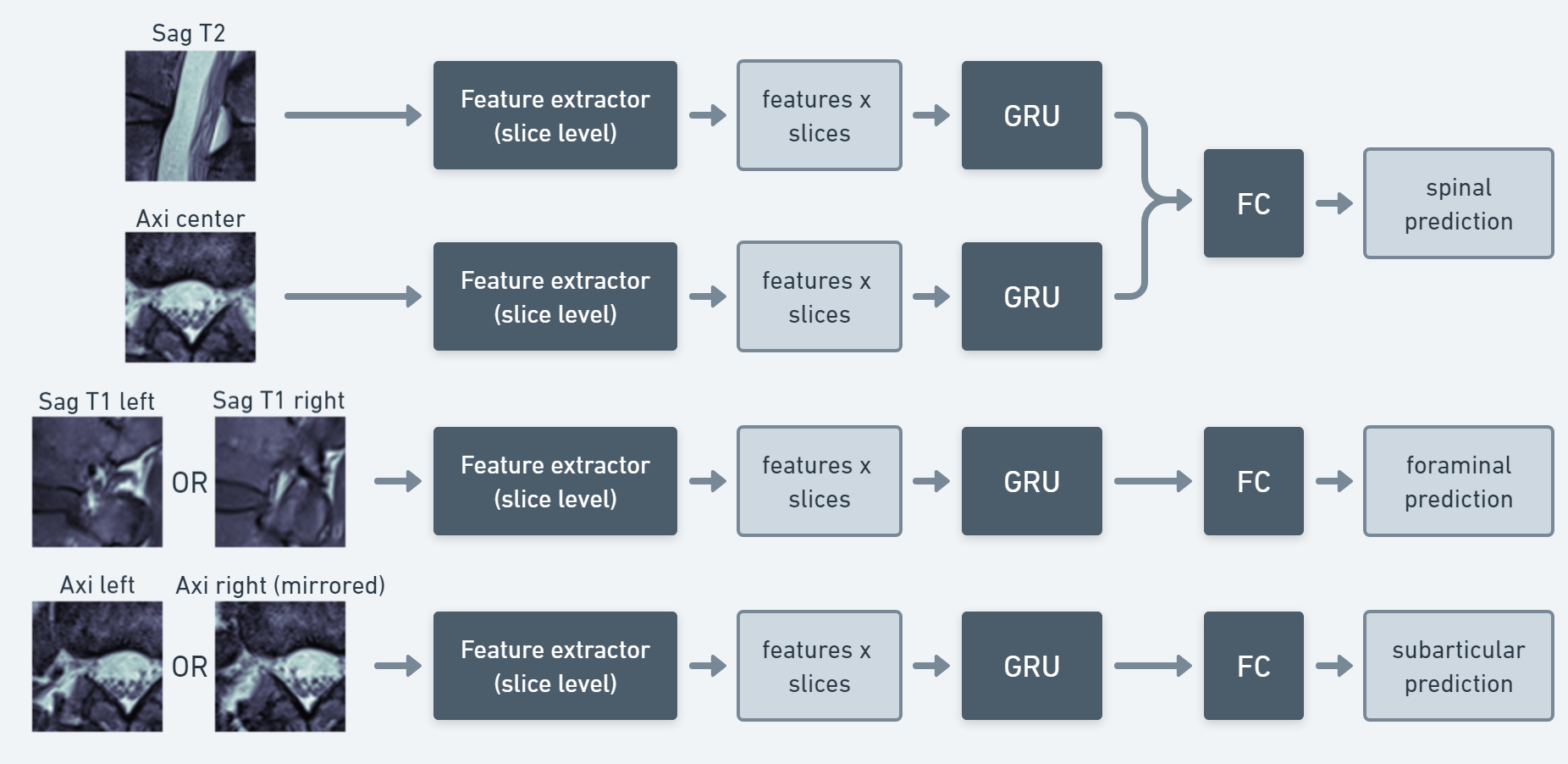 GitHub - adamnarai/kaggle-rsna-2024: Training and validation codes for Lumbar Spine Degenerative ...