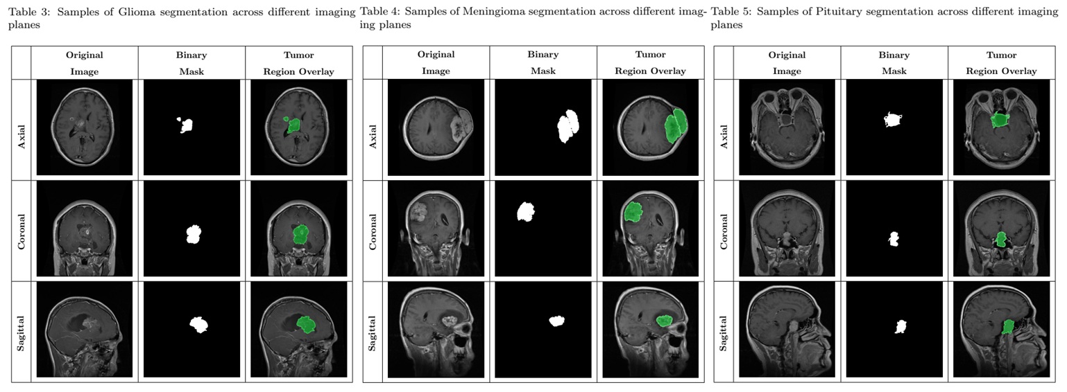 易 BRISC 2025 | Kaggle